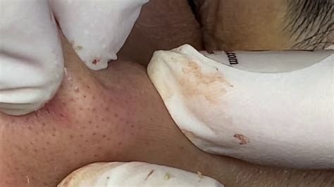 301 Moved Permanently