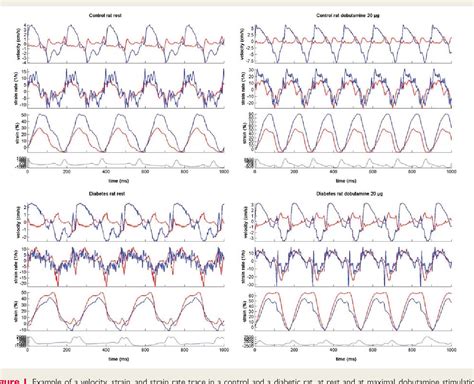 Figure 1 From Evaluation Of Contractile Function And Inotropic Reserve With Tissue Velocity
