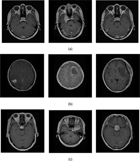 Figure 4 From A Novel Deep Learning Based Brain Tumor Detection Using The Bagging Ensemble With