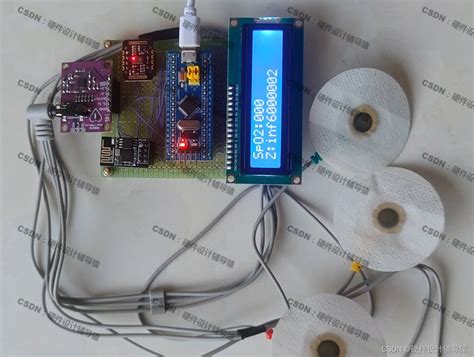 【毕业设计】stm32心电图系统 Csdn博客
