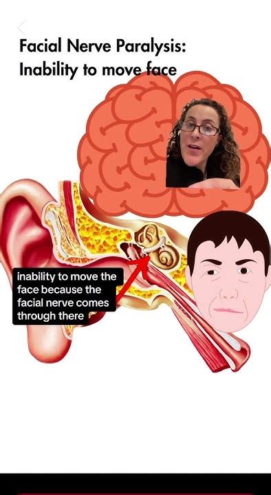 🙉😖 Mastoiditis And Other Complications From Ear Infections Mastoiditis