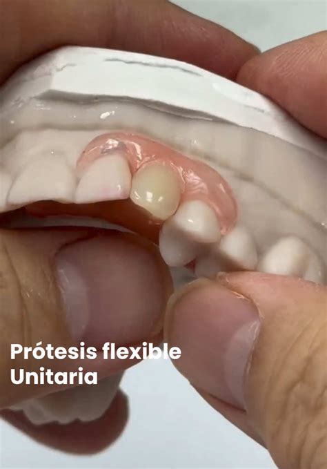 🦷 Ventajas De Una Prótesis Flexible Unitaria La Prótesis Flexible Un