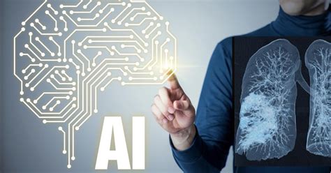 Robert Braun On Linkedin Artificial Intelligence Shows Promise In Mitigating Radiologist Bias