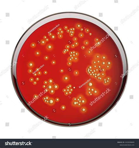 Colonies Bacteria Staphylococcus Aureus On Sheep Stock Illustration 2218308849 Shutterstock