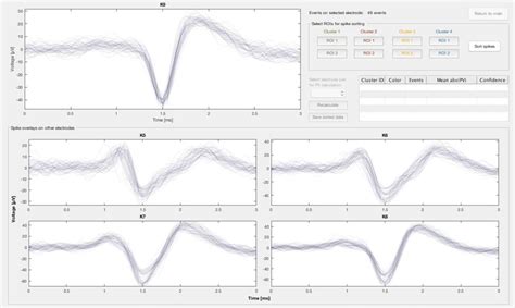 Spike Sorting Graphical User Interface Gui Of µspikehunter Download Scientific Diagram