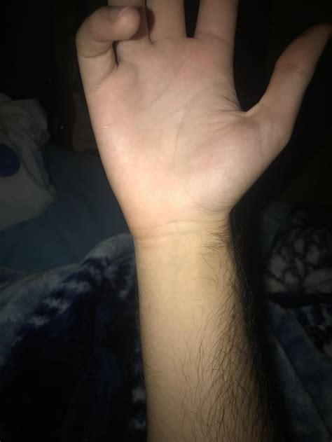 Id Like To Know Something About My Arm Positioning Rfpsaimtrainer