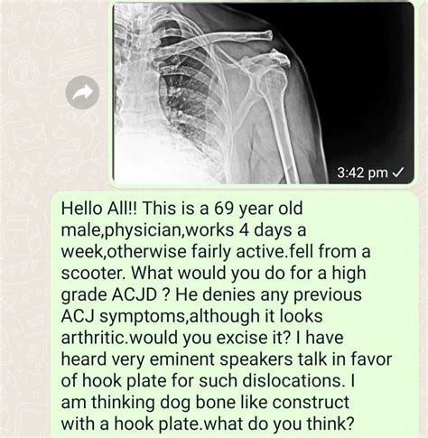 Parag Shah On Linkedin High Grade Acj Dislocation In An Elderly But Active Physician What Is