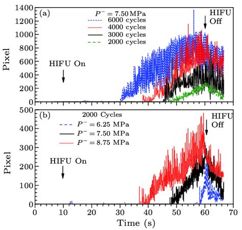 The Temporal Evolution Of The Hifu Induced Cavitation Bubbles In Vitro