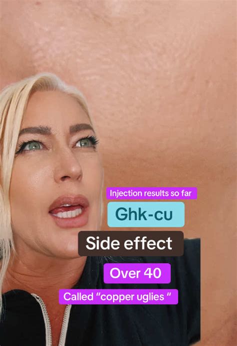 Ghk Cu Understanding Side Effects And Tips Tiktok