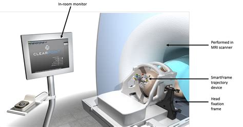 ClearPoint System Overview - MRI Interventions