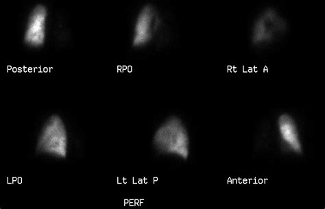 MIR Teaching File Case Vq041