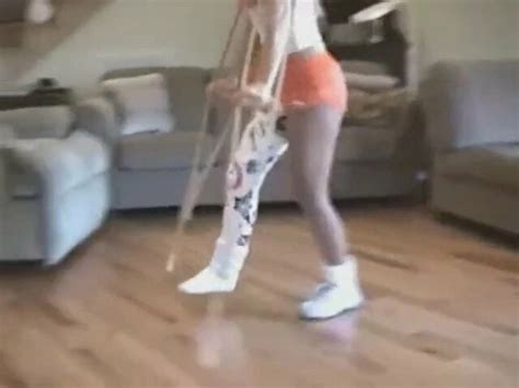 Free Leg Cast Porn Videos Xhamster