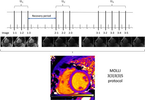 Molli 33335 Protocol Cmr Parametric Sequences For Cardiac T1