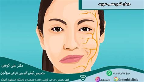 جراحی پیوند عصب صورت رفع فشار عصب صورت