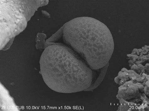 Discovery Of Oldest Microorganisms Preserved In Their Form Tu Berlin