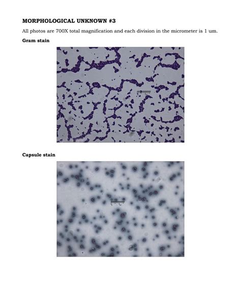 Staphylococcus Epidermidis Capsule Stain