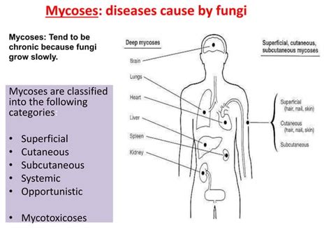 2 Superficial Cutanous Andsystemic Ppt