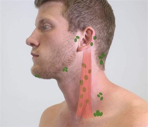 Увеличени шийни лимфни възли Sanitas Bg