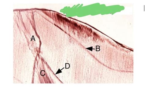 Bone Microstructure Flashcards Quizlet