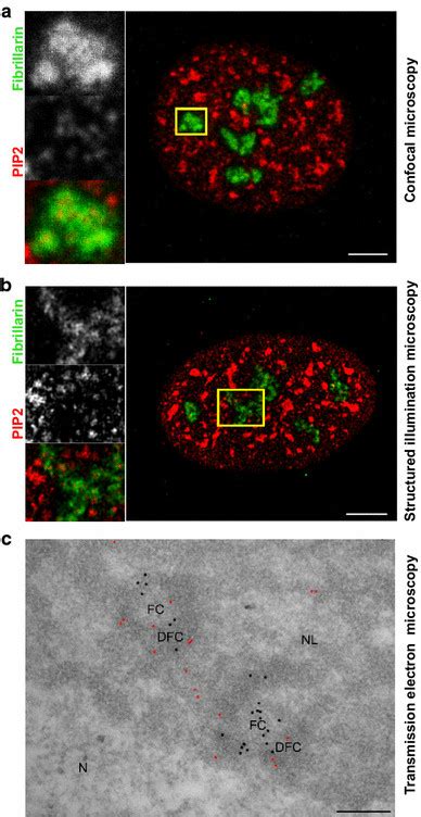 Localization Of Fibrillarin And Pip2 In The Nucleoli In Cm Sim And Em