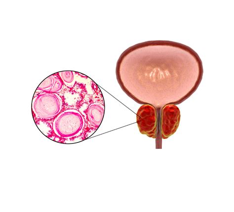 Pure Encapsulations Dimpro 100 Supporting Healthy Breast Cervical