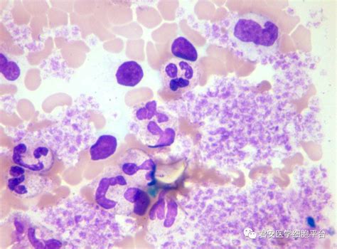 红细胞缗钱状排列居然是因为“他