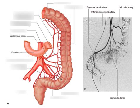 Inferior Mesenteric Artery