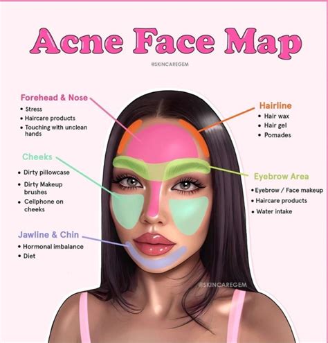 Acne Face Map Artofit