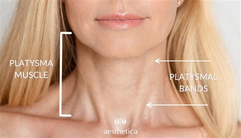 Nefertiti Botox Neck Lift Aesthetica Medical Spa