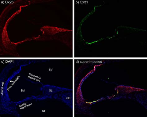 Expression Of Cx31 And Cx26 In The Mouse Cochlea Examined By Download Scientific Diagram