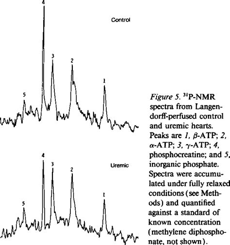 Figure 1 From Impairment Of Cardiac Function And Energetics In