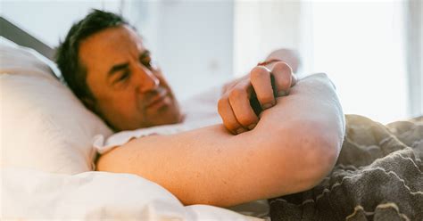 Itching As A Symptom Of Gallbladder Cancer