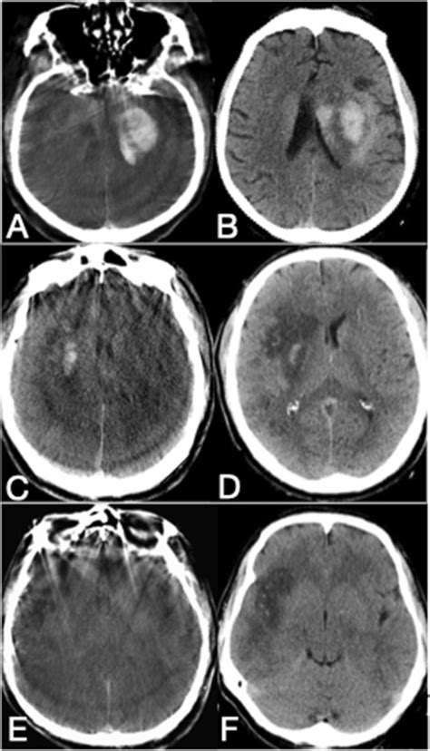 A The Machine Learning Ml Evaluation Of The Cone Beam Computed Download Scientific Diagram