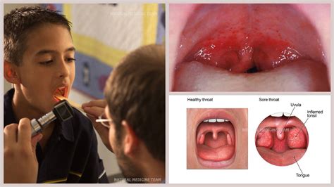 Causes Of Throat Infections