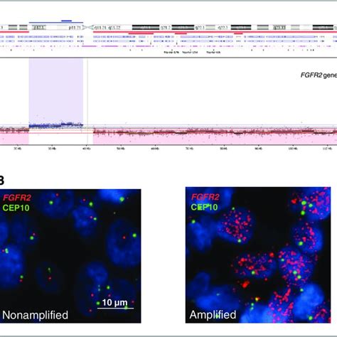 Fgfr2 Gene Amplification In Chinese And Caucasian Gastric Cancer
