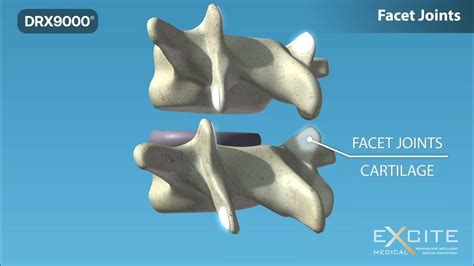 What Is Spinal Decompression How Does The Drx9000 Work Youtube