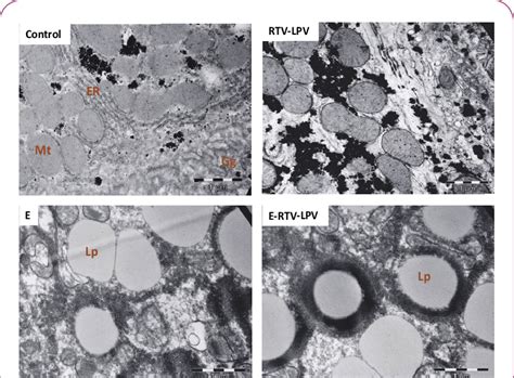 Endoplasmic Reticulum Microscope