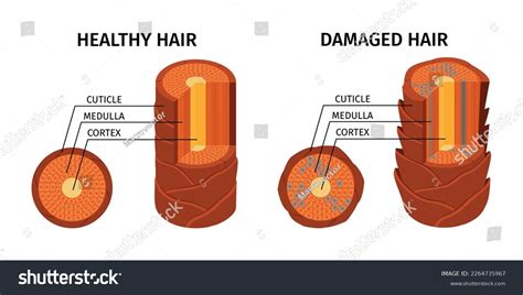 The Hair Cortex Plus De 1 016 Images Vectorielles De Stock Libres De Droits Proposées Sous