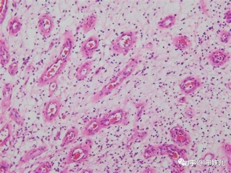 切片学习 常规病理组织切片及诊断要点 知乎