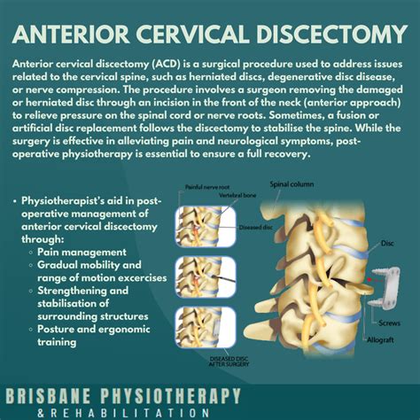 Anterior Cervical Discectomy Brisbane Physiotherapy And Podiatry
