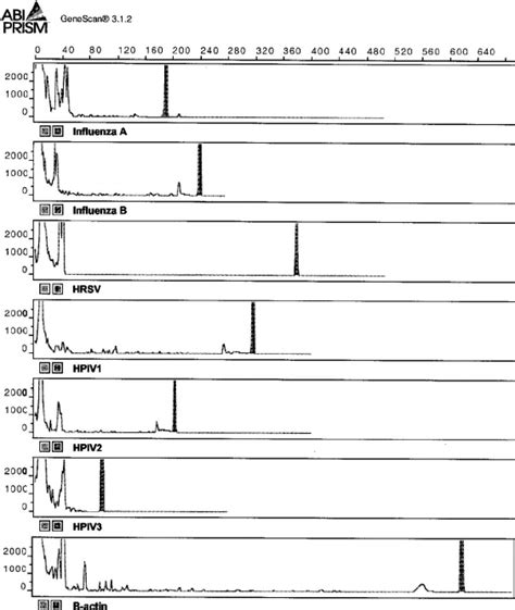 Electropherogram Of Genescan Analysis Results Showing Rt Pcr Ampli Fi