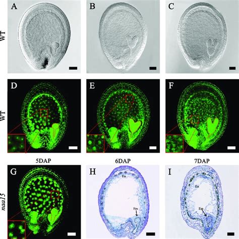 Embryo Differentiation And Endosperm Cellularization In Wt And Naa15 Of