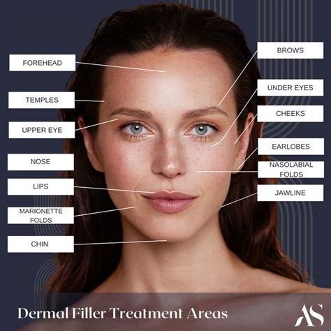 Dermal Fillers In 2022 Dermal Fillers Face Fillers Injectables Fillers