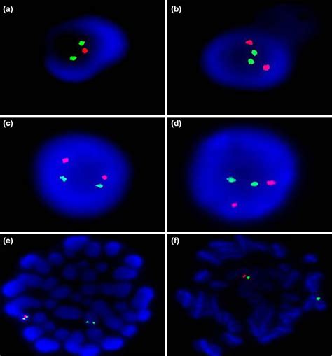 Fluorescence In Situ Hybridization Fish Analysis Of The Interphase