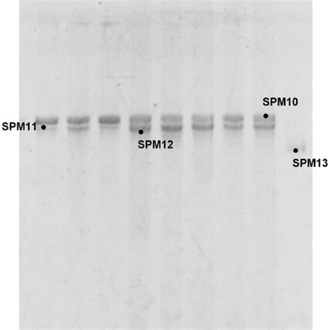 Denaturing Gradient Gel Electrophoresis Dgge Profile Of Pcr Products