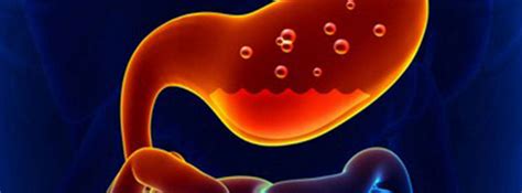 functional dyspepsia a rome iv mdcp perspective cme learning center cme learning overview