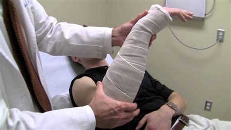 Sugar Tong Splint For Distal Radial Fracture At Patricia Peralta Blog