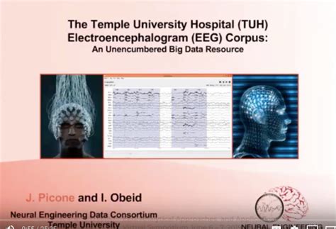 The Temple University Hospital Eeg Corpus Sapien Labs Shaping The Future Of Mind Health
