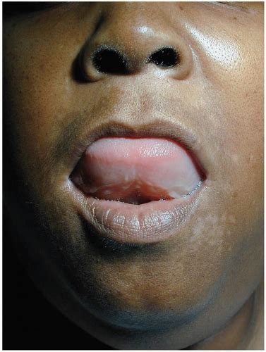 Airway Breathing Circulation Anesthesia Key