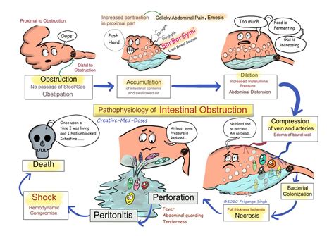 Catheter Obstruction Symptoms At Patsy Carranza Blog